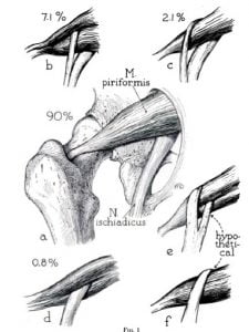 O quadril e a dor pélvica crônica, dor glútea profunda e “síndrome do ...